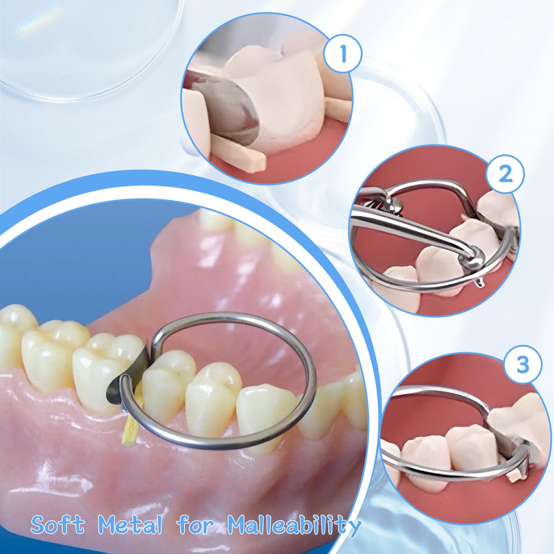 100 Pieces Stainless Steel Sectional Contoured Metal Dental Matrices ...