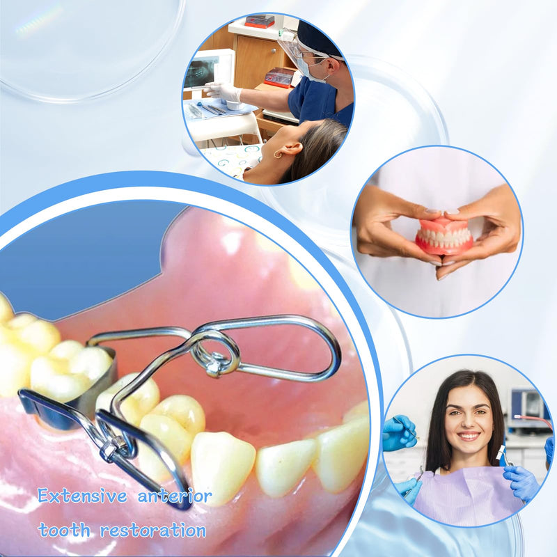 30 Piece Dental Anterior Matrix Kit with Proximal Strips and Twin ...